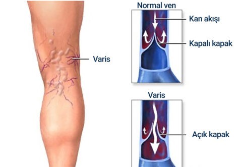 Varis | Atabay